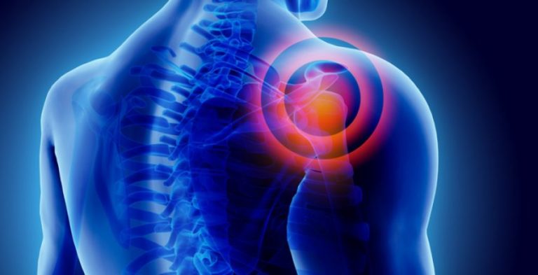 Rotator Cuff Injuries are Common Work Injuries | Mooney Law